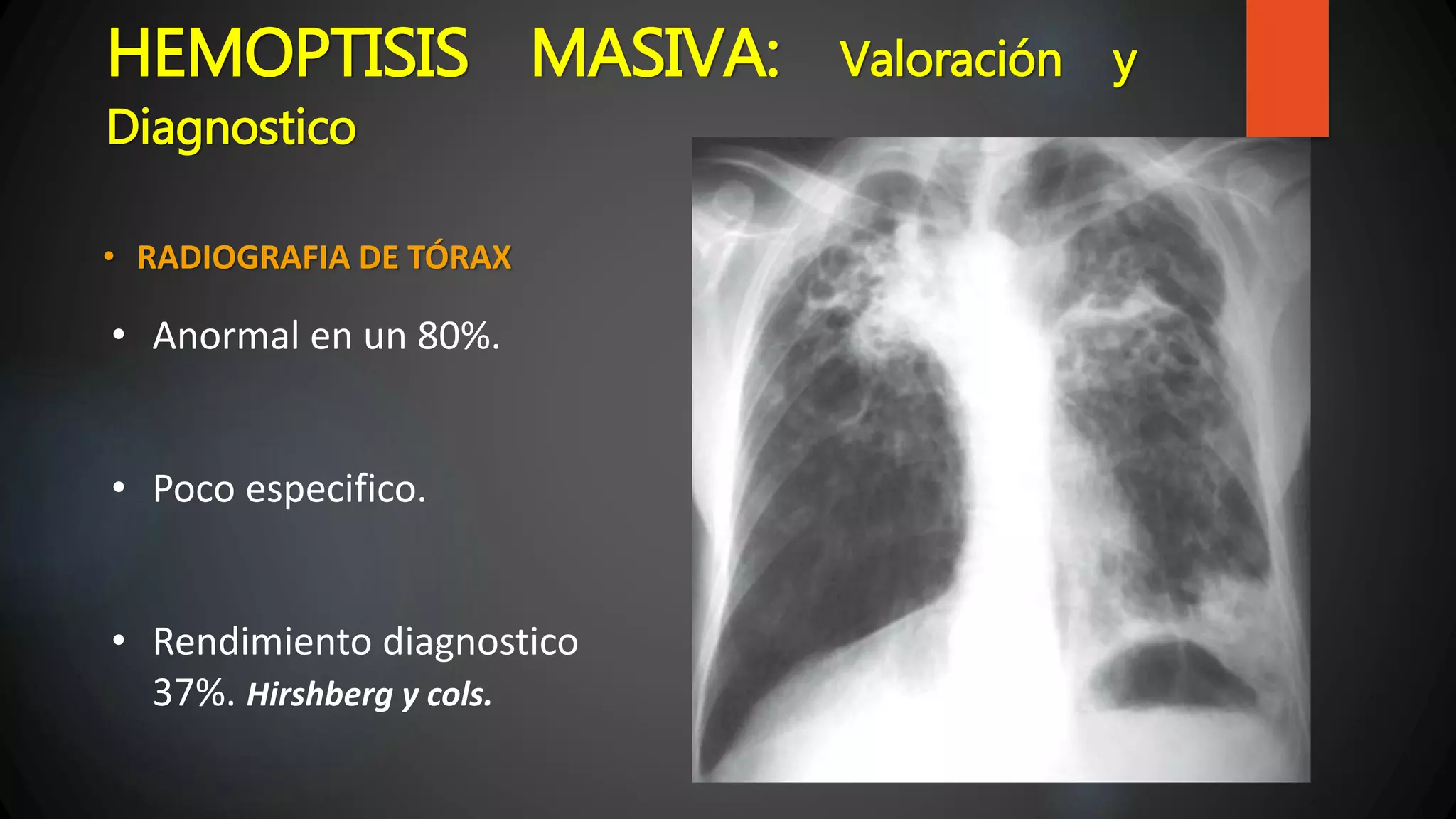 Hemoptisis masiva y hemorragia alveolar | PPT