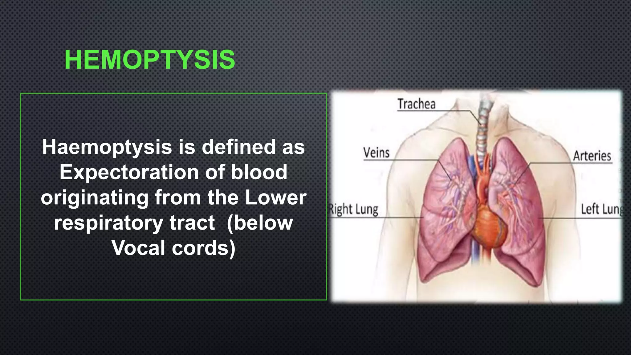 Hemoptysis and its management | PPTX