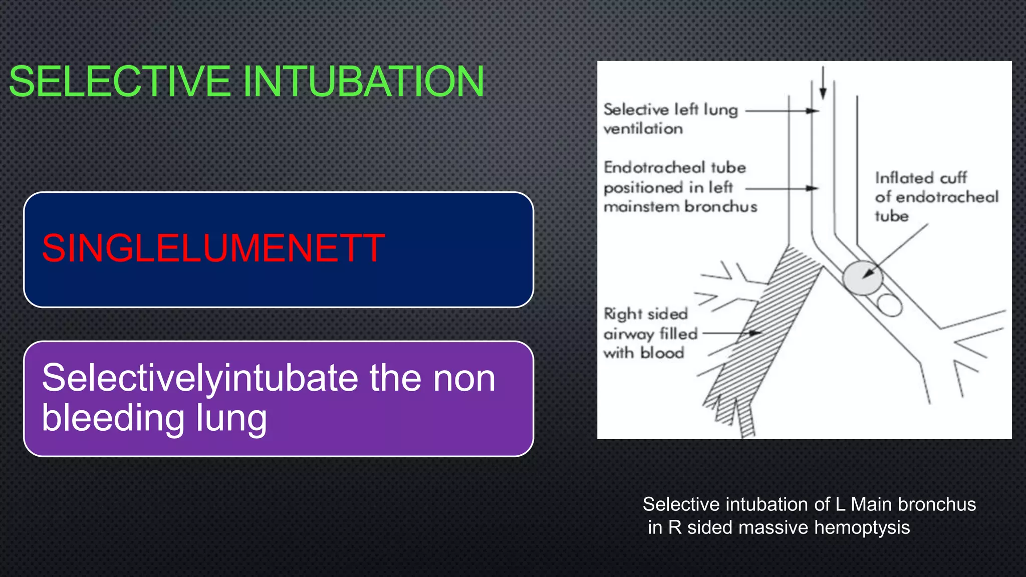 Hemoptysis and its management | PPTX
