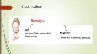Hemoptysis | PPTX