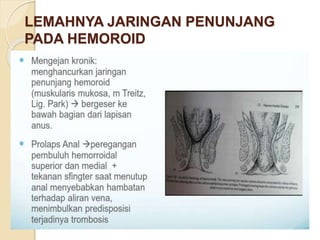 Hemoroid | PPTX