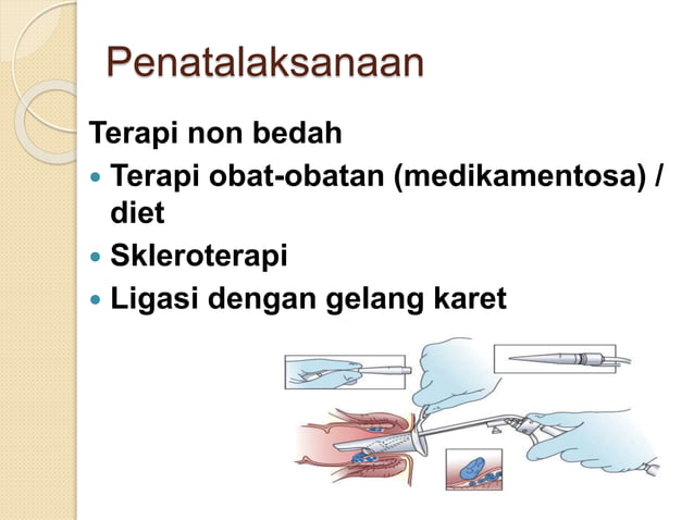 Hemoroid | PPTX
