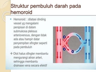 Hemoroid | PPTX