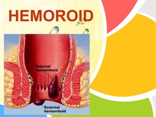 HEMOROID interna dan eksterna pada pasien rumah sakit.pptx