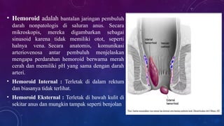 Asuhan keperawatan pada pasien hemoroidd | PPT