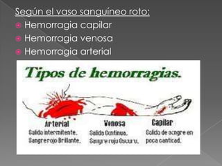 Hemorragia | PPTX