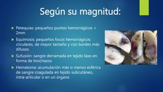 HEMORRAGIA.pptx