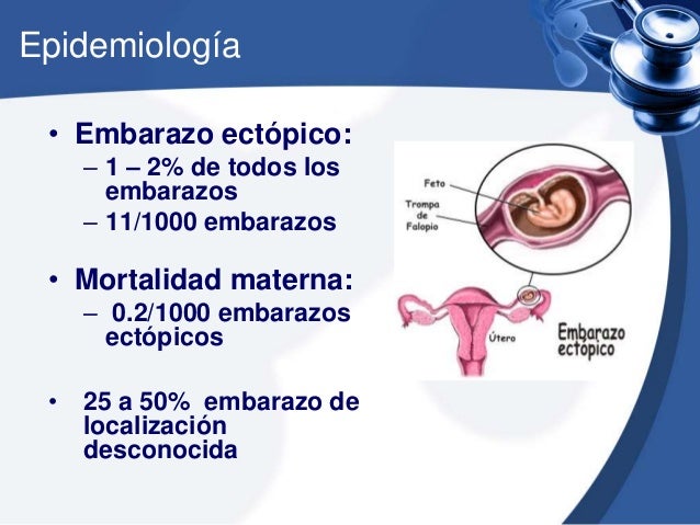 El embarazo ectopico: EPIDEMiOLOGIA