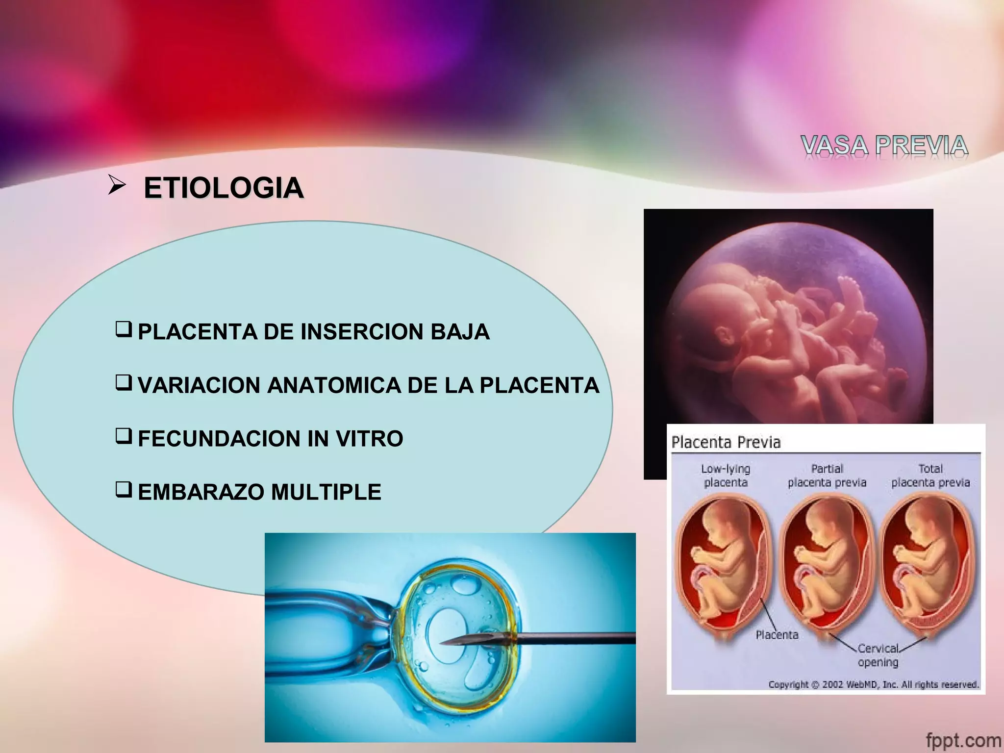Hemorragia de la segunda mitad del embarazo | PPT