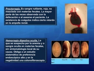 hemorragia digestiva parte alta uci.pptx