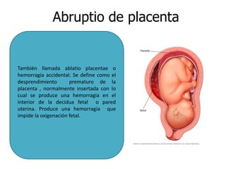 Hemorragia en la gestacion | PPTX