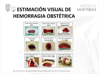 Hemorragia Obstétrica.pdf