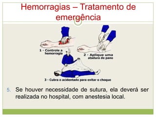 Hemorragias | PPTX