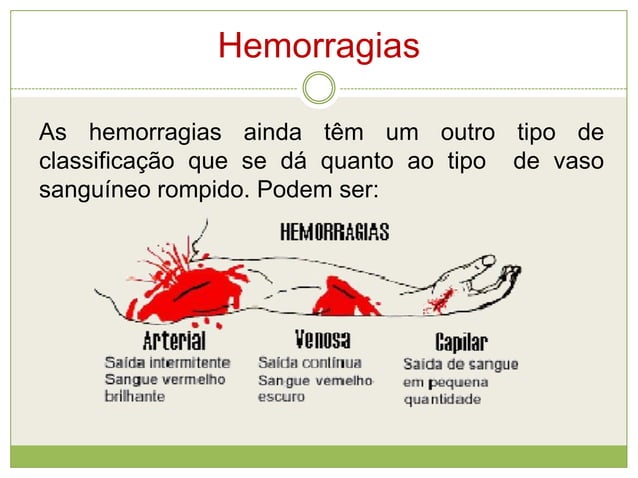 Hemorragias