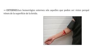 Hemorragies | PPT