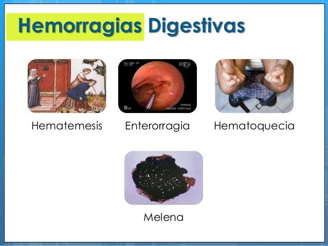 Hemorragias Exteriorizadas