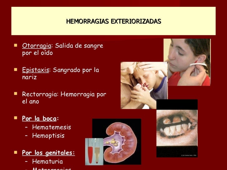 Hemorragia Externa Primeros Auxilios