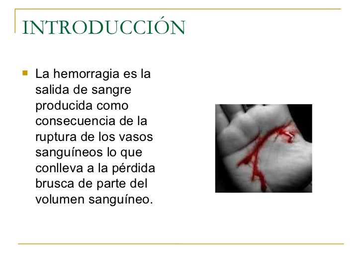 Hemorragias sesión clínica