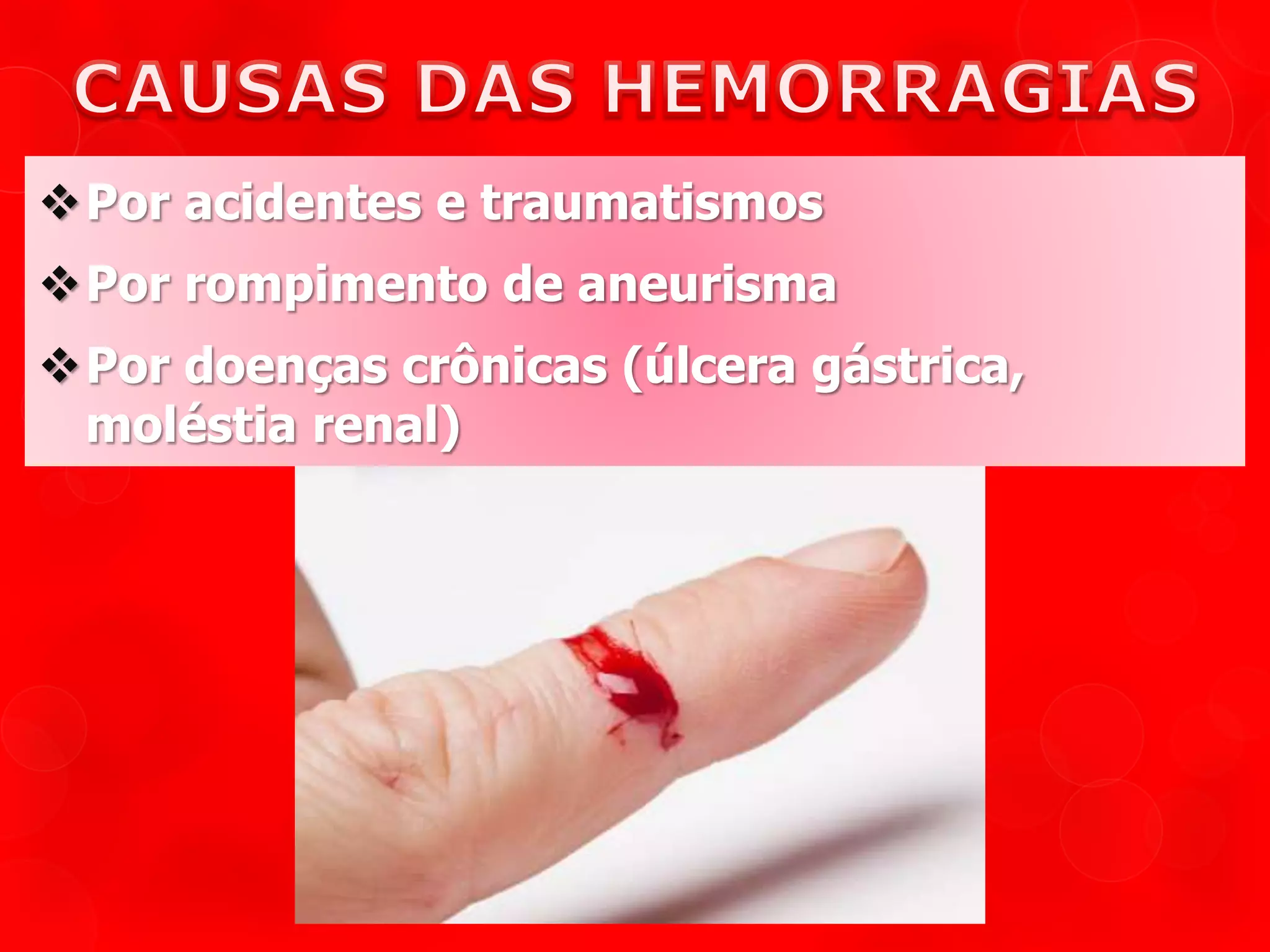 Hemorragias | PPTX