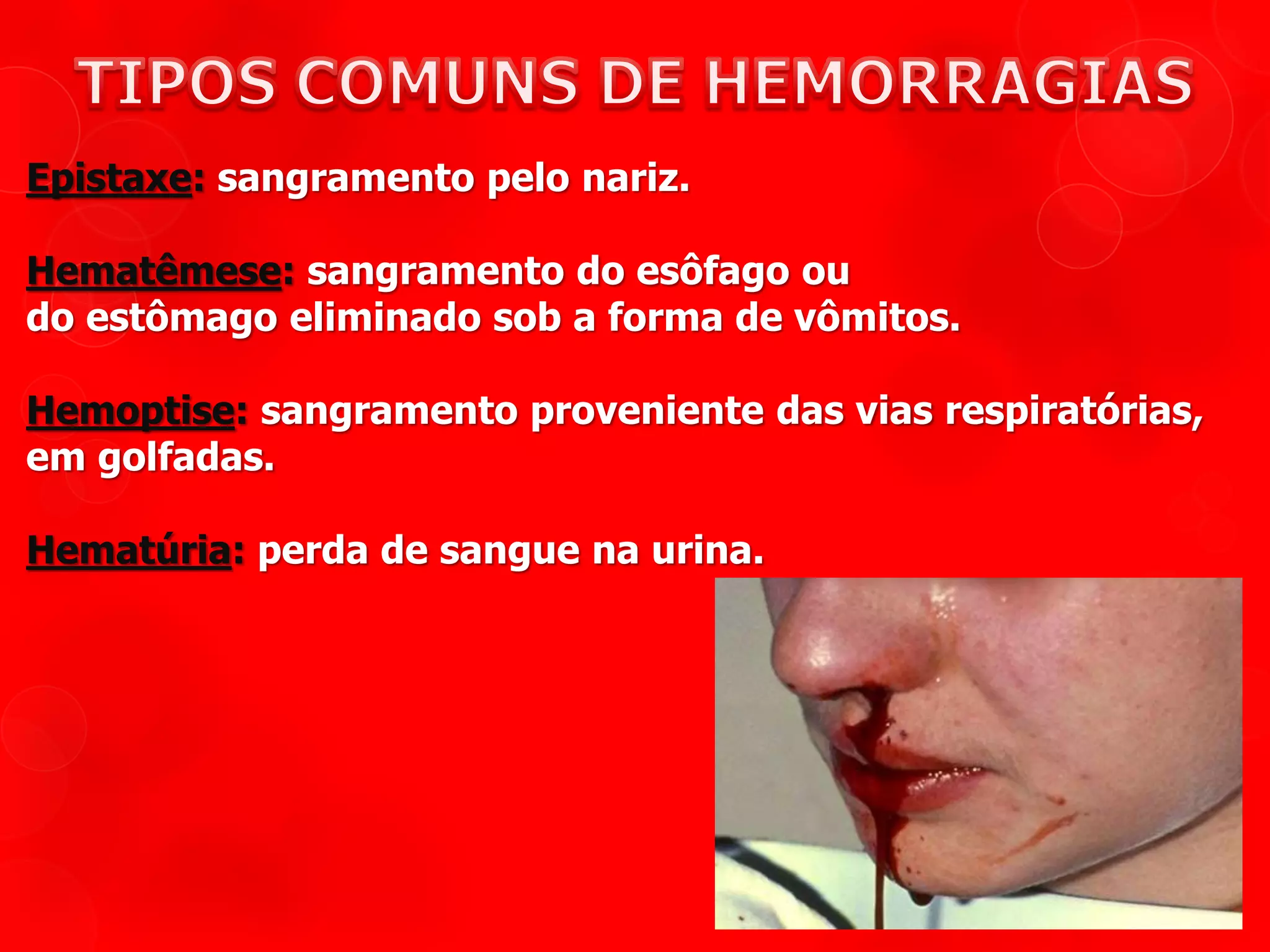 Hemorragias | PPTX | First Aid | Injuries