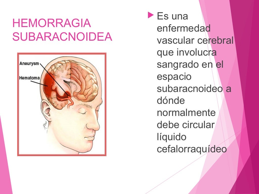 Hemorragia Subaracnoidea