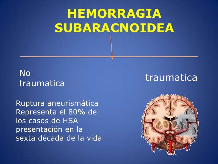 Hidrocefalia Secundaria A Hemorragia Subaracnoidea Por