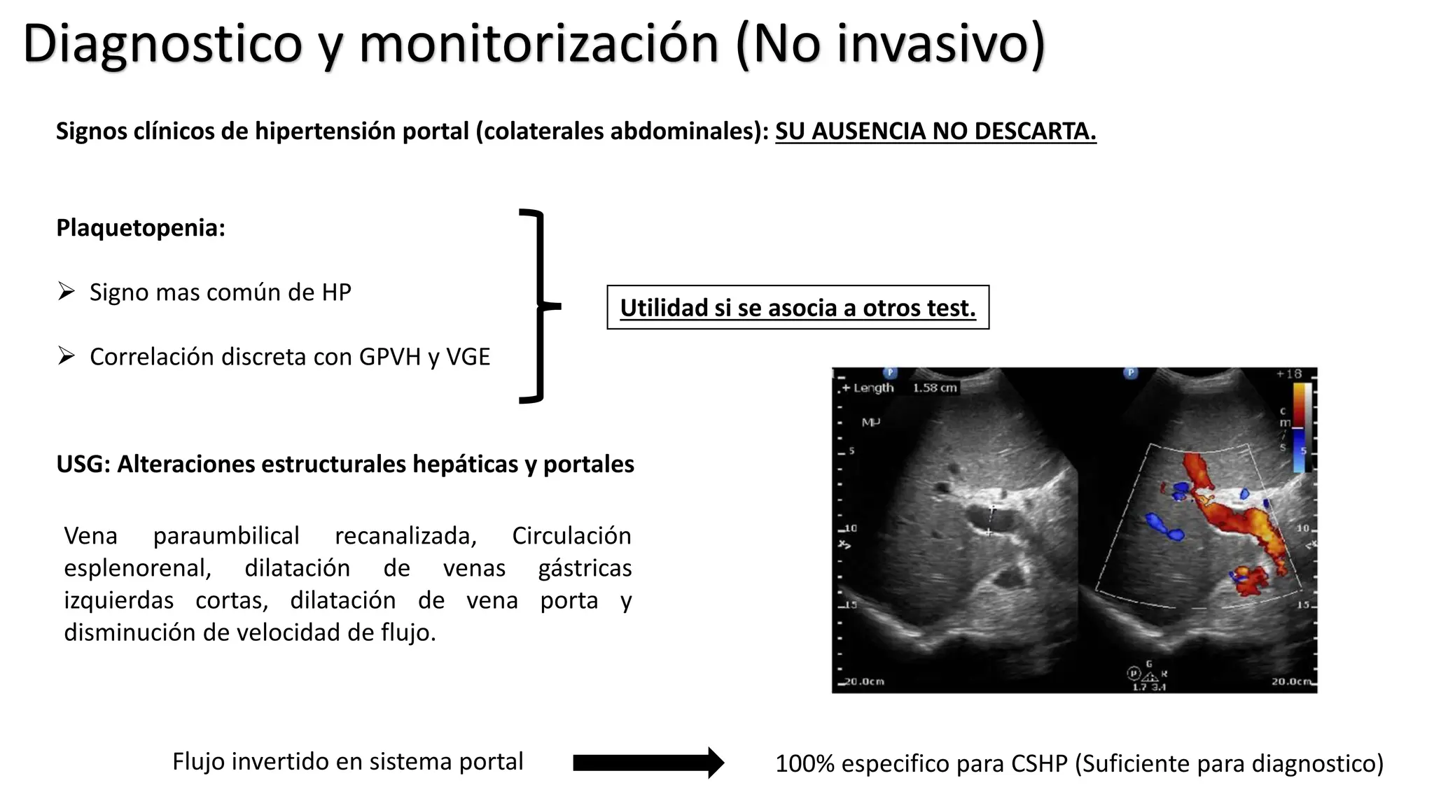 hemorragia variceal FINAL BUENO SEGUN GUIAS ACTUALIZADA ASSLD.pptx