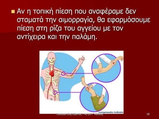 6α. ΑΙΜΟΡΡΑΓΙΕΣ: ΕΞΩΤΕΡΙΚΗ ΑΙΜΟΡΡΑΓΙΑ | PPTX