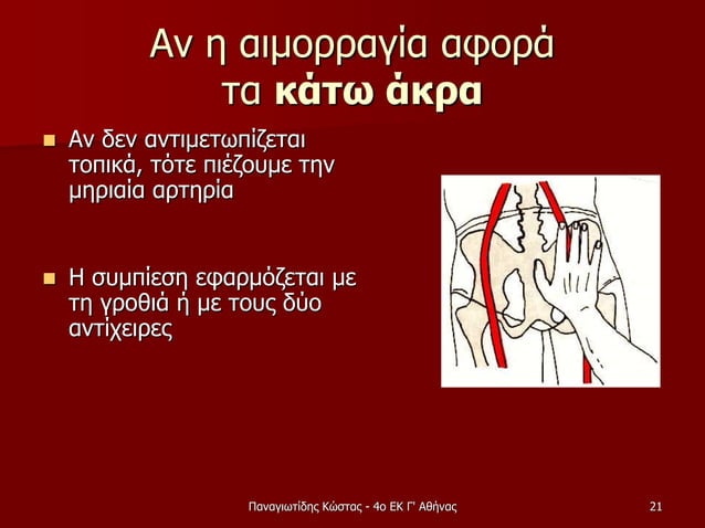 6α. ΑΙΜΟΡΡΑΓΙΕΣ: ΕΞΩΤΕΡΙΚΗ ΑΙΜΟΡΡΑΓΙΑ | PPTX