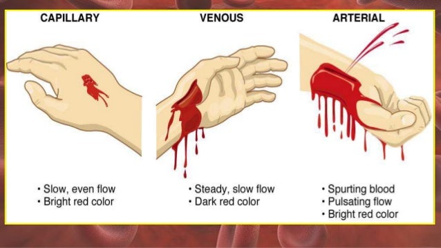 Hemorrhage and its Management
