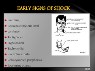 Hemorrhage and shock | PPTX