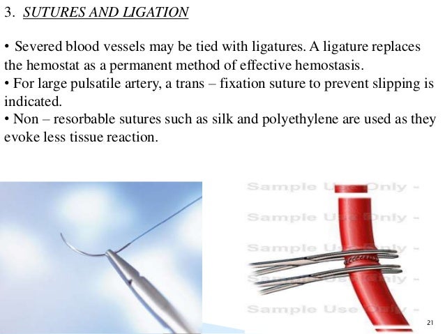 Hemorrhage and its Management