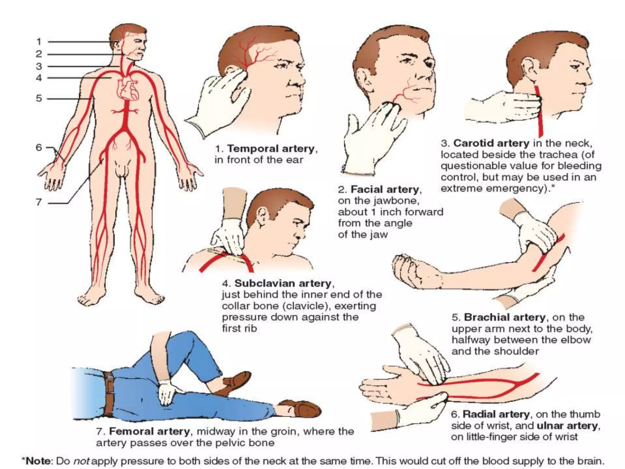 Hemorrhage | PPTX