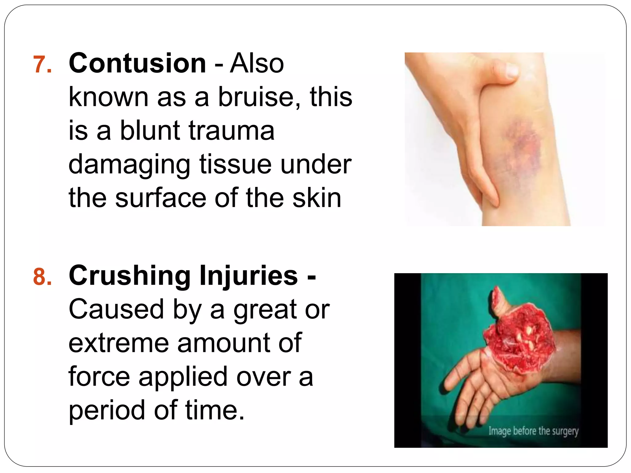 hemorrhage.pptx
