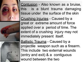 Presentation of Management of hemorrhage.pptx