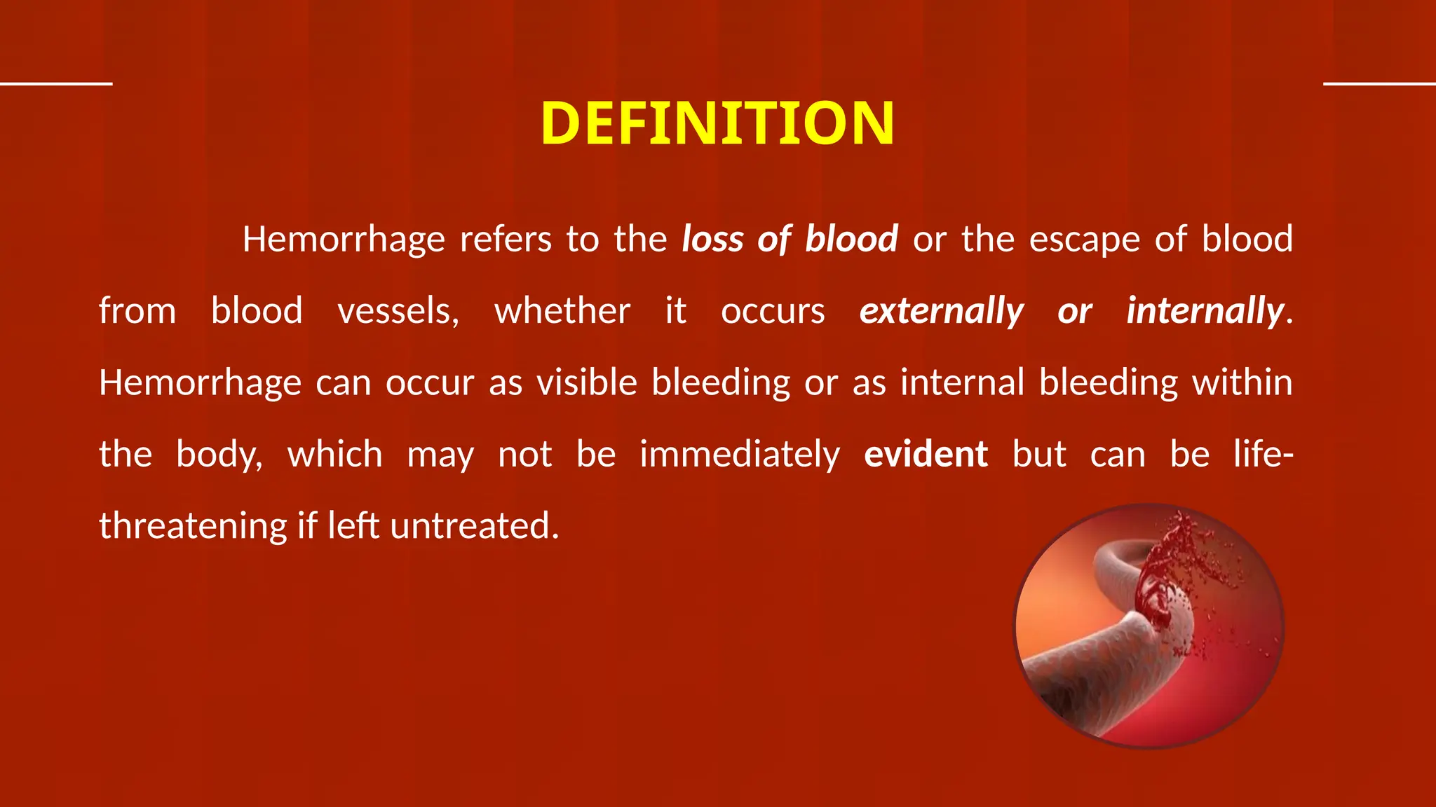 HEMORRHAGE IN CHILDREN: CAUSES,TYPES,TREATMENT,PREVENTION.pptx