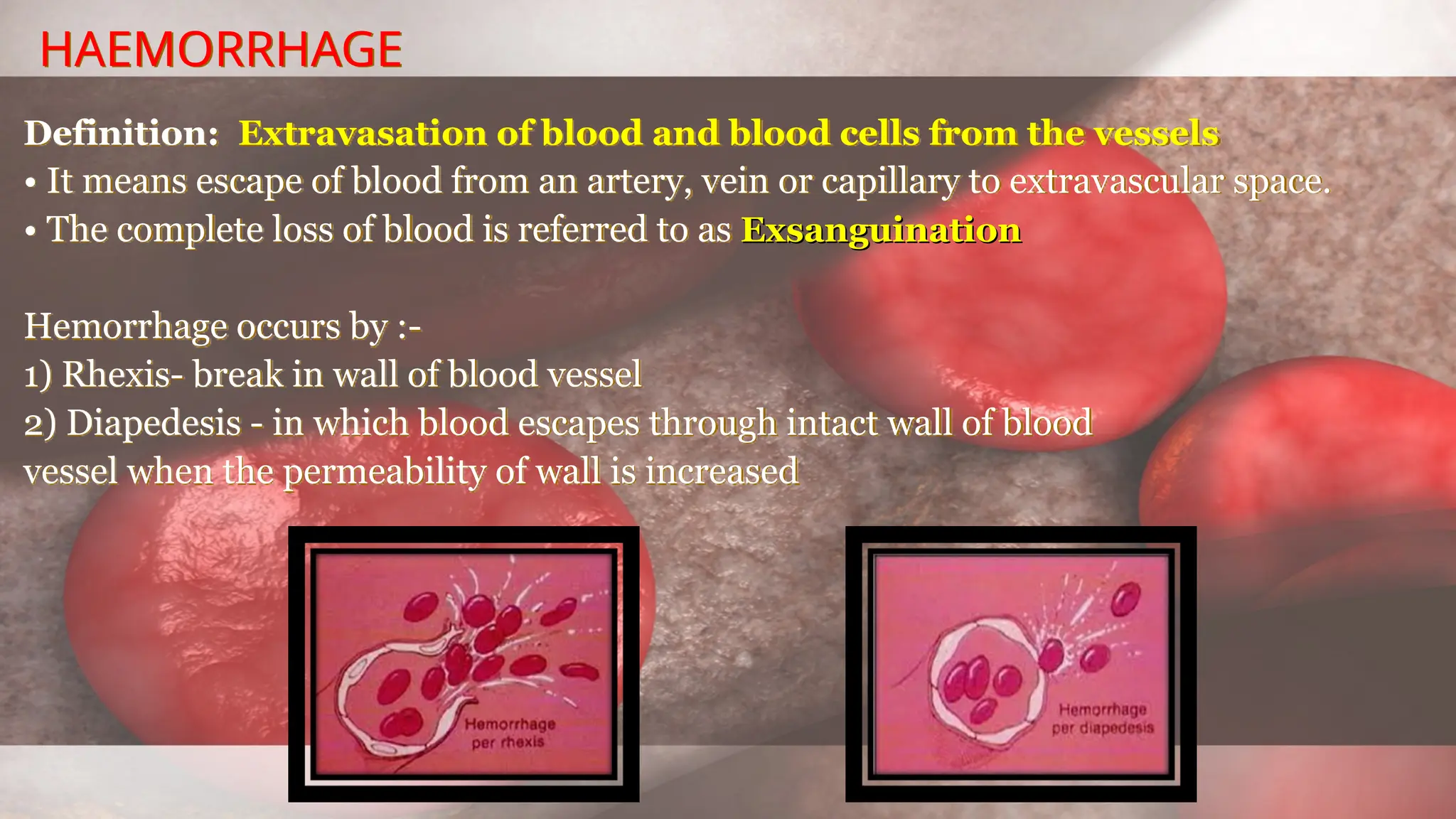 Hemorrhage and Haemostasis : Recent techniques to stop hemorrhages.ppt