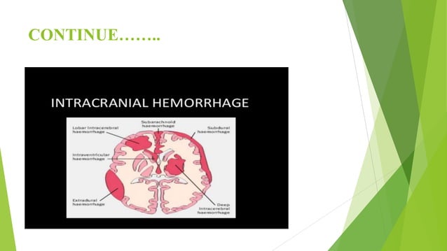 Hemorrhage and shock | PPTX | First Aid | Injuries