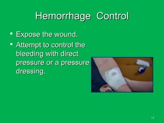 Hemorrhage control | PPT