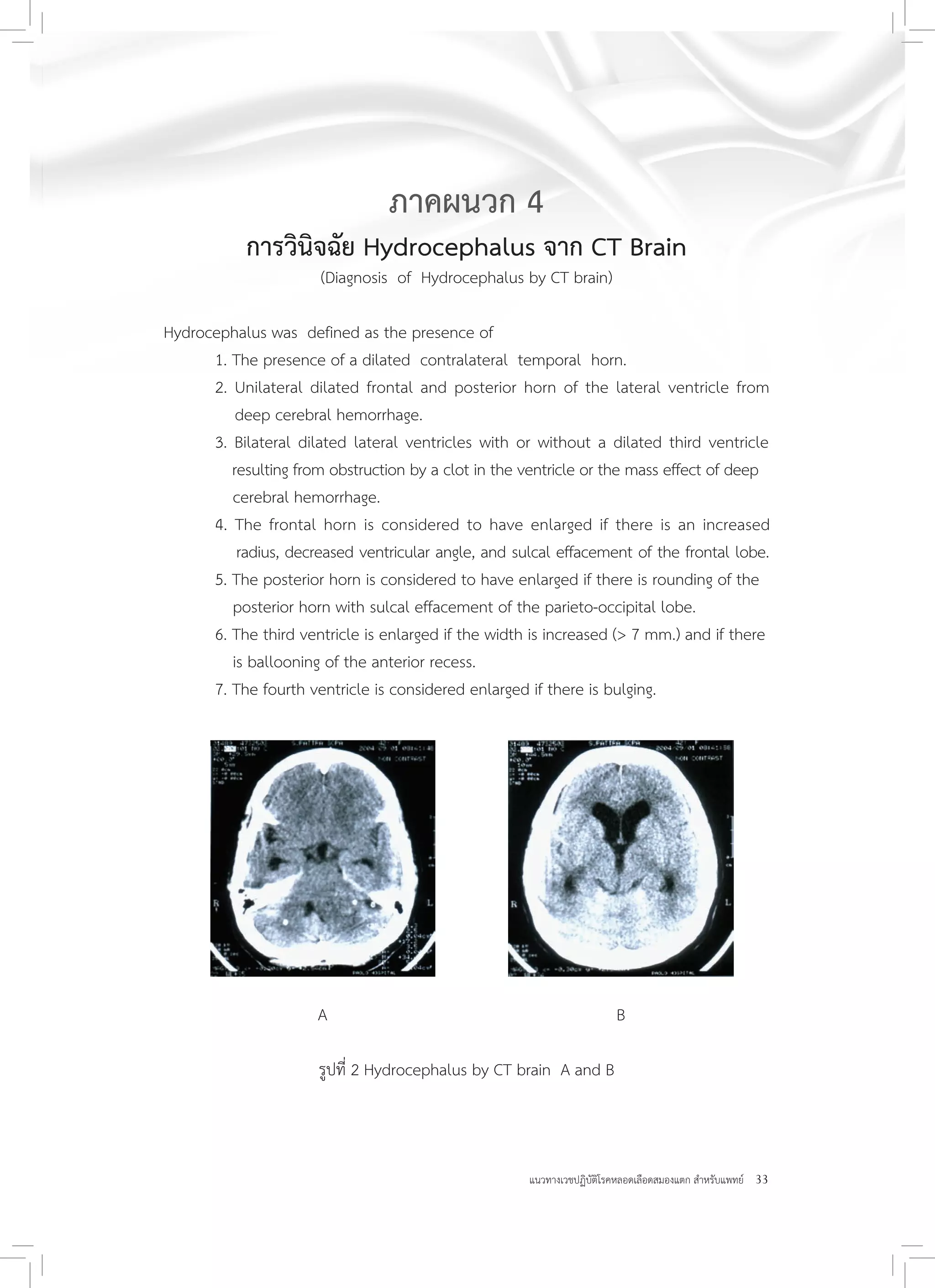 CPG Thai hemorrhagic stroke 2551 | PDF