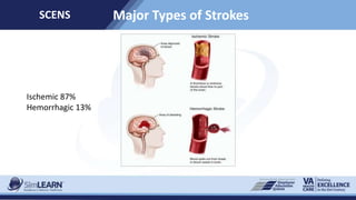 hemorrhagic stroke.pptx