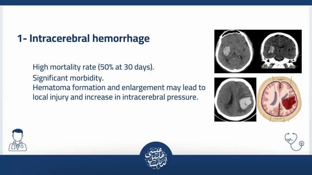 Hemorrhagic Stroke.pptx
