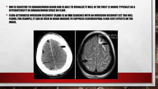 Hemorrhagic strokes ,Subarachnoid and Intrracerebral | PPTX