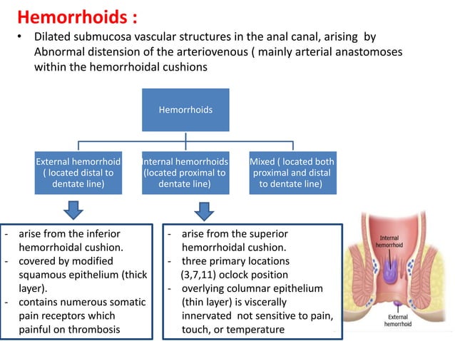 Hemorrhoid | PPTX | Digestive Disorders | Diseases and Conditions