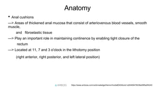 Hemorrhoids | PPTX