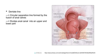 Hemorrhoids | PPT