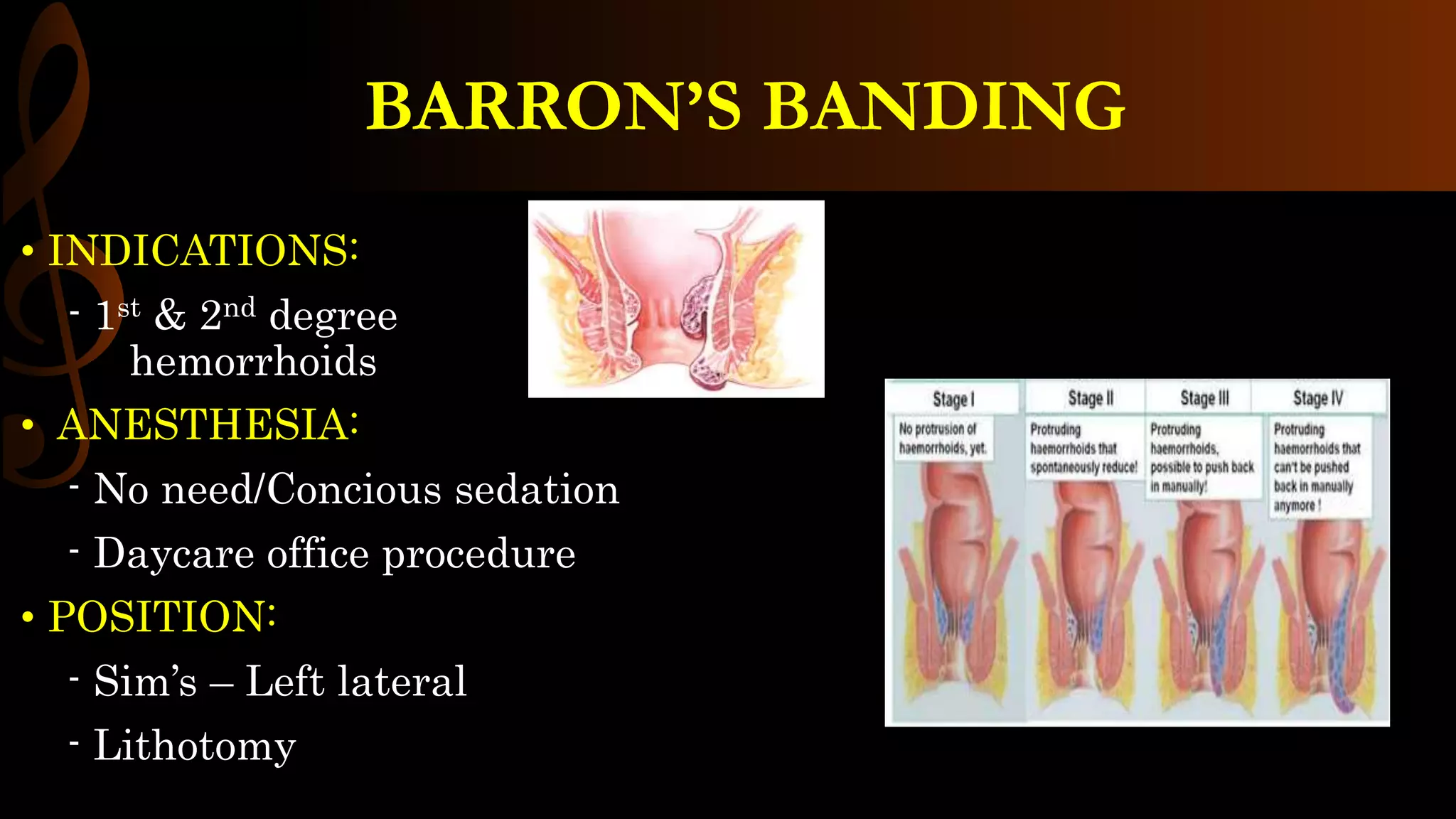 Hemorrhoidectomy/ operative surgery | PPTX
