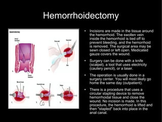 Hemorrhoids 1235093240420575 1 | PPT