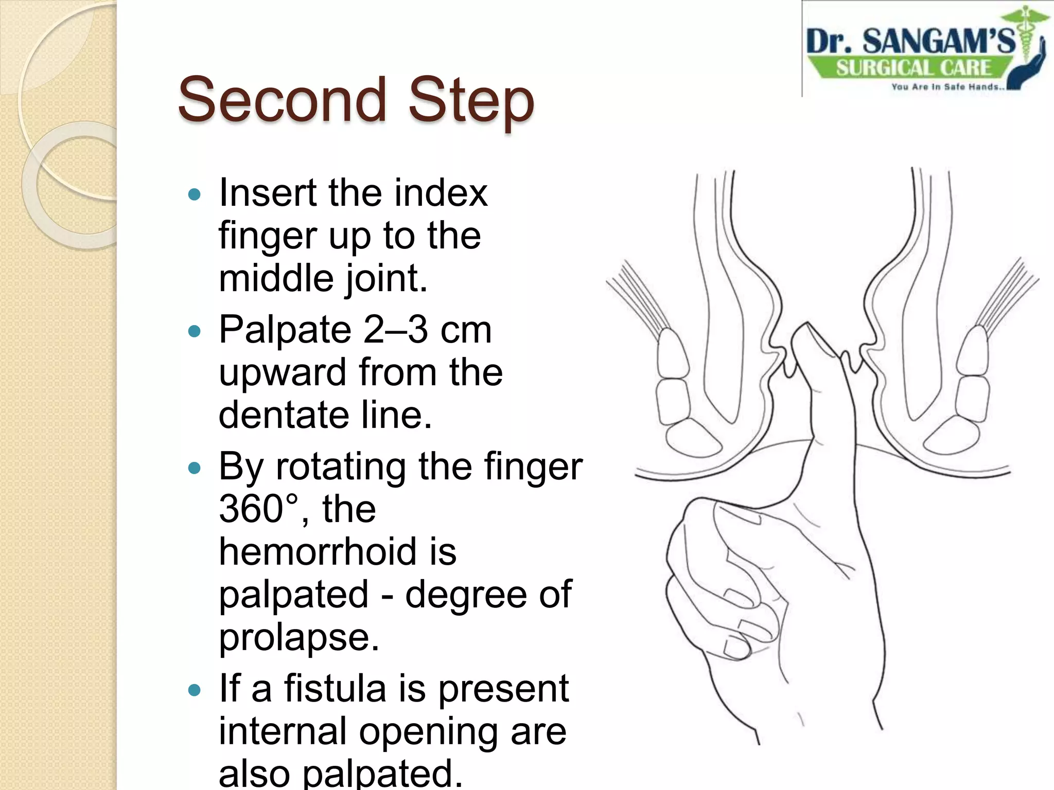 Hemorrhoids - Piles | PPTX