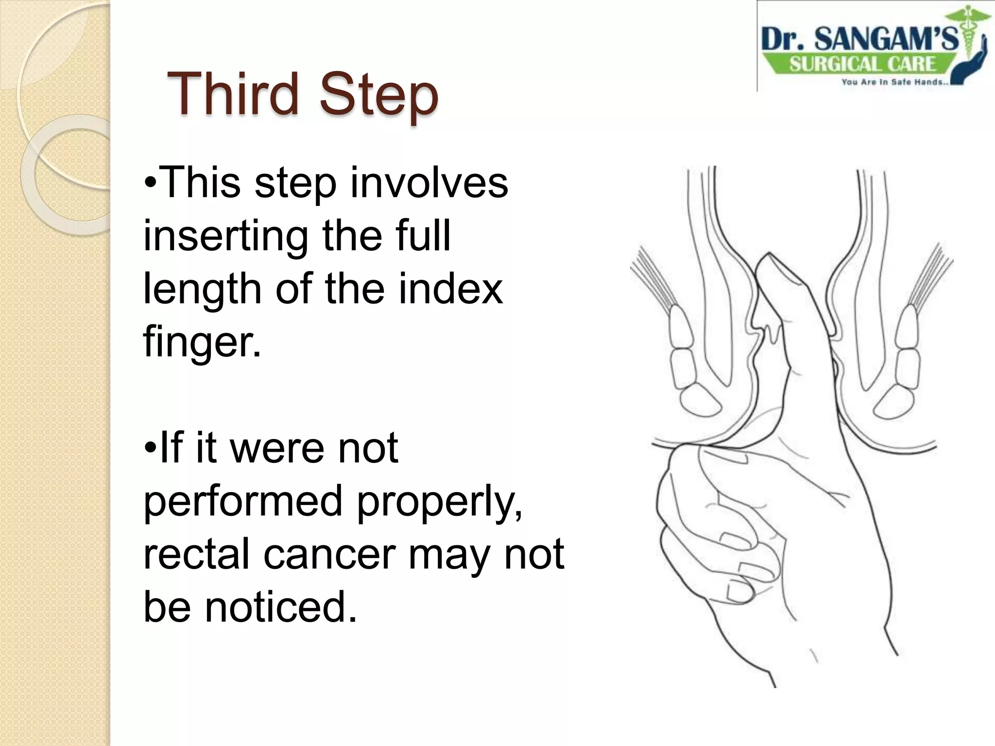 Hemorrhoids - Piles | PPTX